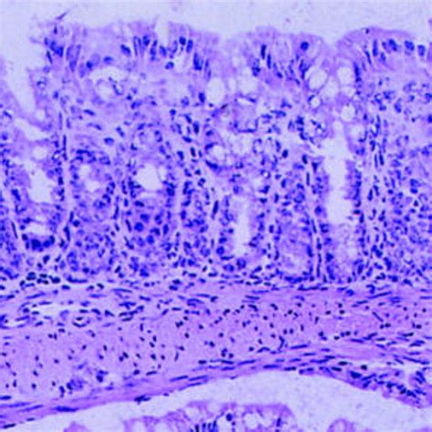 Transgenic Mice Carrying Murine Il 7 Cdna By The Srα Promoter Developed