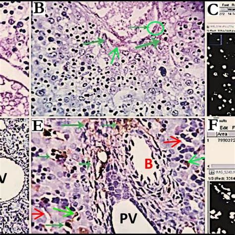 Prenatal A B And Postnatal D E Liver Tissues Stained With