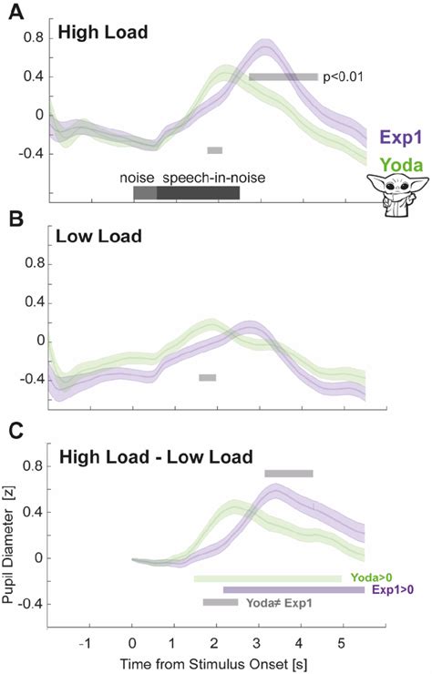 Sentence Structure Modulates Latency Of Pd Response A Pd In The Hl