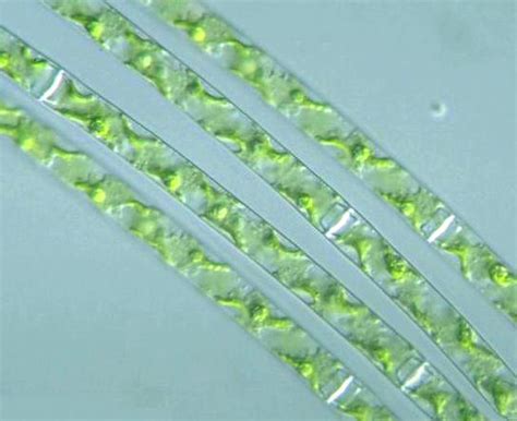 Protist Images Spirogyra