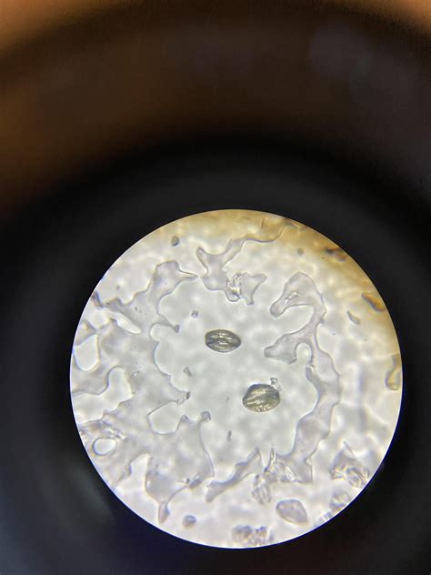 Pinworm Scotch Tape Test