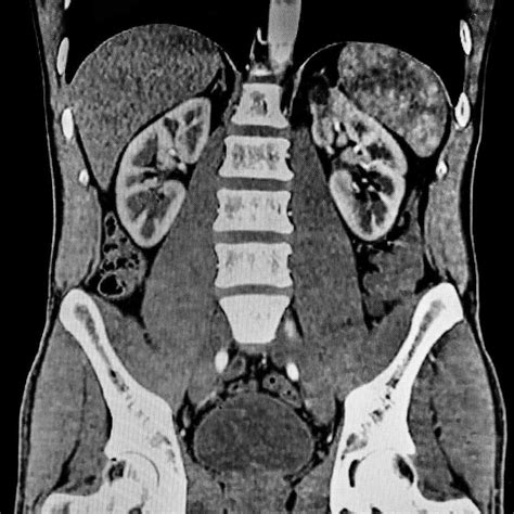 Ct Scan Abdomen Godawari Ct Scan