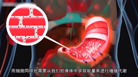 这是治疗癌症的最新实验结果“饿死”癌细胞腾讯视频