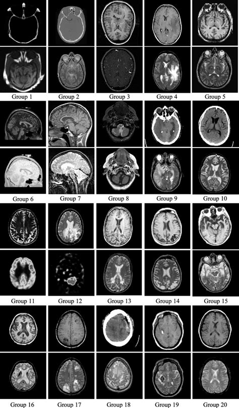 Medical Image Dataset Consisting Of 20 Pairs Of Multi Modality Medical Download Scientific