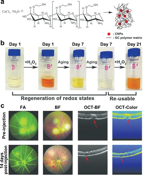 Auto‐regenerative Antioxidant Significantly Attenuates Choroidal