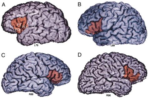 Inferior Frontal Gyrus