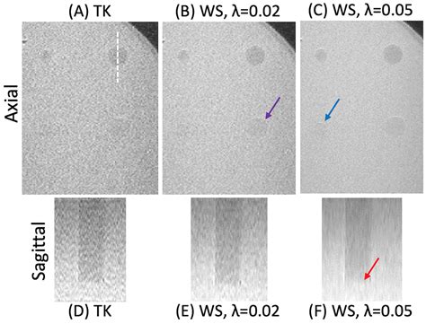 Model Based Image Reconstruction With Wavelet Sparsity Regularization For Through Plane