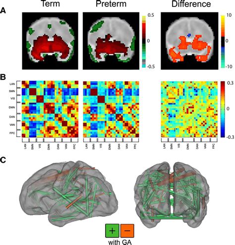 functional connectivity differences between term and very preterm