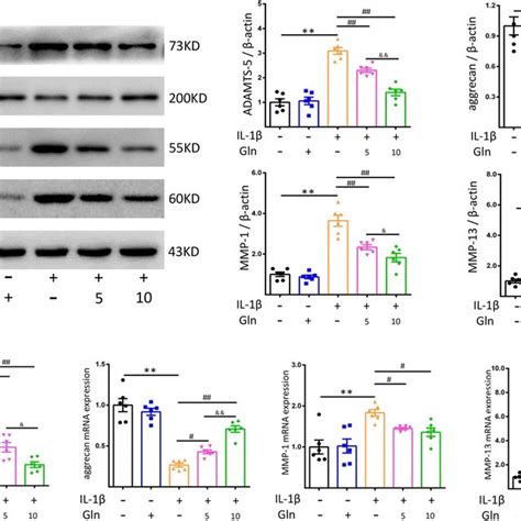 The Action Of Mmp 13 In Cancer Progression And Metastasis Mmp 13