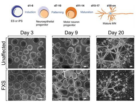 Figures And Data In Fmrp Promotes Rna Localization To Neuronal