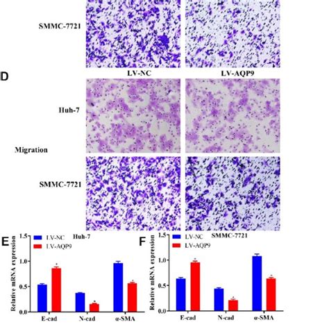 Overexpressed AQP9 Inhibited Invasion Migration And EMT In HCC Cells