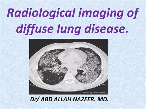 Presentation1 Pptx Radiological Imaging Of Diffuse Lung Disease