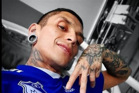 Osteomielitis La Infección De Javier Acosta El Hincha De Millonarios