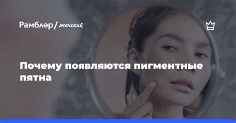 Почему появляются пигментные пятна Рамблер женский