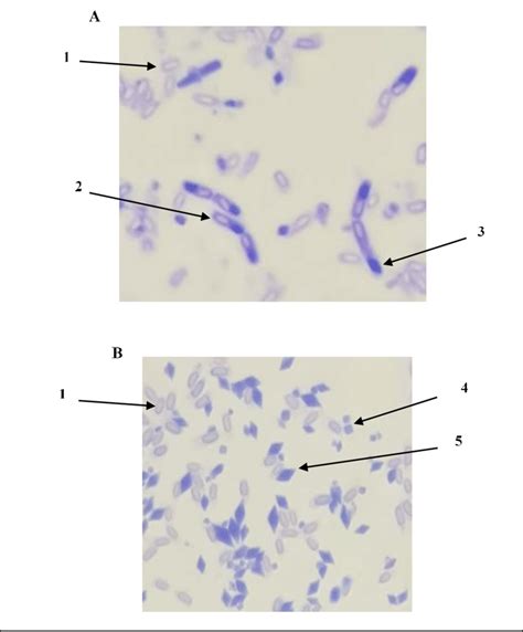 Light Microscopy Of B Thuringiensis Isolate 7 A Sporulated B