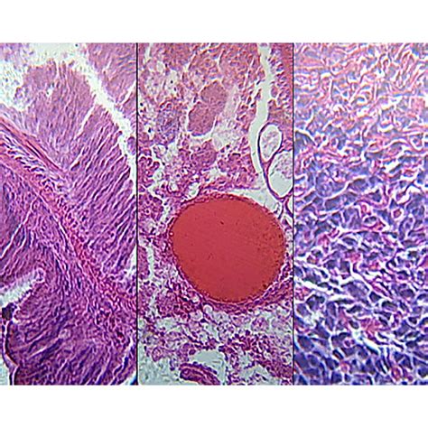 Earthworm Head Under Microscope