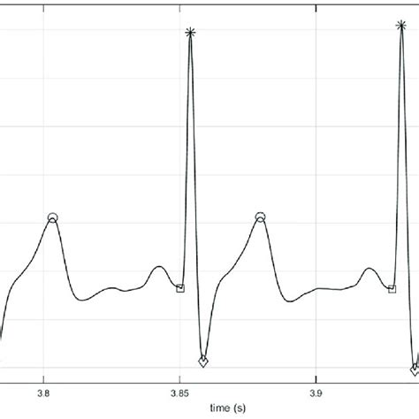 Portion Of ECG Signal Uploaded From The PTB Diagnostic ECG Database