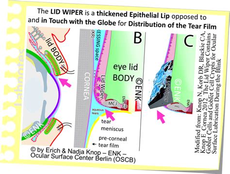 Overview On The Lid Margin — Ocular Surface Center Berlin