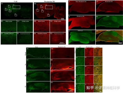Prog Neurobiol︱吉林大学李艳超团队研发出新型神经元死亡检测方法对神经疾病研究具有重要和深远意义 知乎