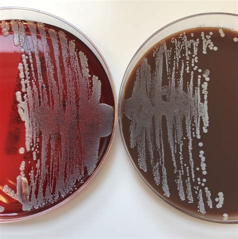 Dr Microbe