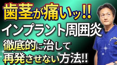 歯周病がインプラントの周りに？歯茎の腫れ？治療方法と再発防止を歯科医が解説【インプラント周囲炎】膿炎症歯茎の痛み歯医者 Youtube