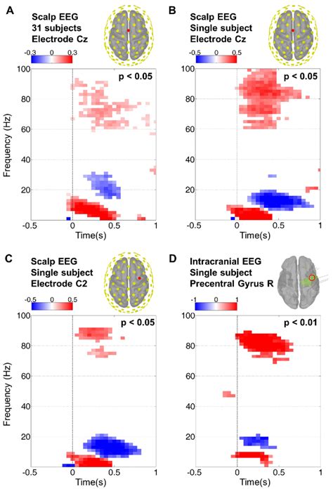 comparison of intracranial eeg with scalp eeg in group and single