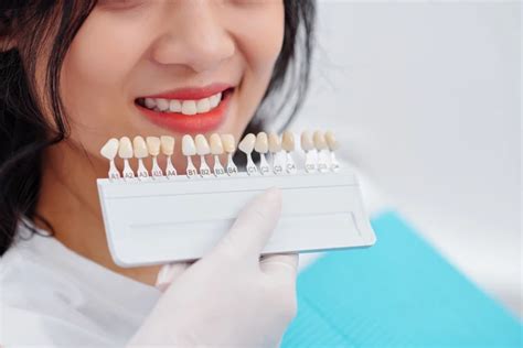 Veneer Direct Di Shiny Smile Dental Hdmall