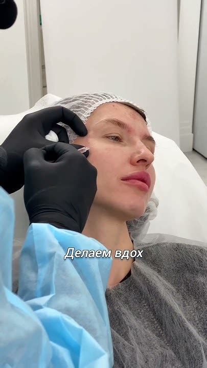 Убираем гусиные лапки Youtube