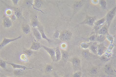 Is My Mcf 7 Cancer Cells Being Contaminated Researchgate