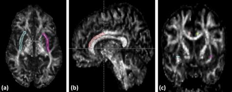 Demonstration Of The Placement Of Regions Of Interest Roi For The Roi Download Scientific