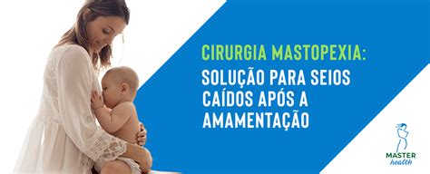 Cirurgia Mastopexia Solução Para Seios Caídos Blog Master Health
