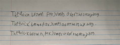 Dysgraphia Wikipedia