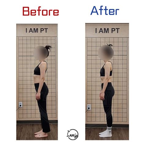 미사 Pt 자고 일어나면 목이 아픈 이유 해결 방법 Feat 허리 골반 전방 경사 네이버 블로그