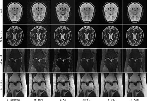 Nerf Solves Undersampled Mri Reconstruction Paper And Code Catalyzex