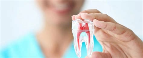 Root Canal Treatment In Tunbridge Wells Free Consultation
