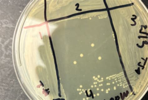 Solved Find The Colony Forming Units Cfus ﻿on Agar Plate