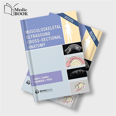 Musculoskeletal Ultrasound Cross Sectional Anatomy