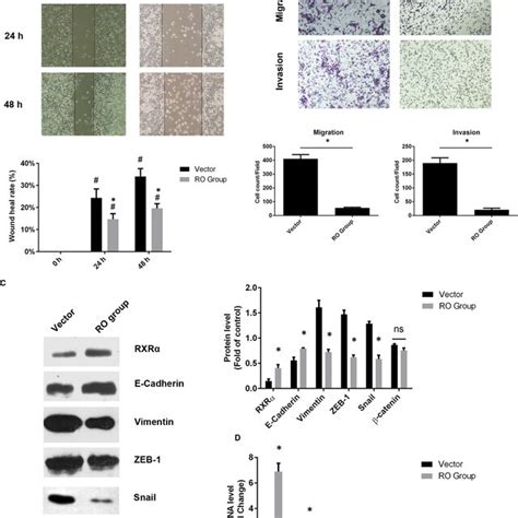 Epithelial‐mesenchymal Transition‐associated Proteins Expressed In