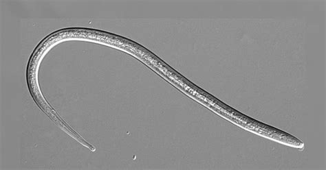 피부 뚫고 감염되는 기생충…인체 안에서 어떻게 길 찾을까 [와우 과학]