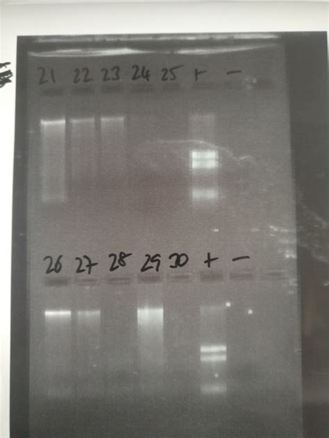 218 Questions With Answers In Plasmid Dna Isolation Scientific Method