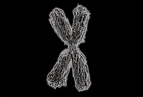 X Chromosome Variants Help Explain Autisms Sex Bias Spectrum Autism Research News Trendradars