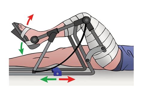dcpm f knee ankle cpm continuous passive motion machine cpm physical therapy rooemed