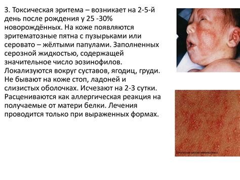Анатомо физиологические особенности доношенного новорожденного