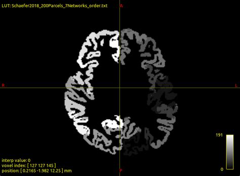 Problem In Dwifslpreproc” Mrtrix3 Community