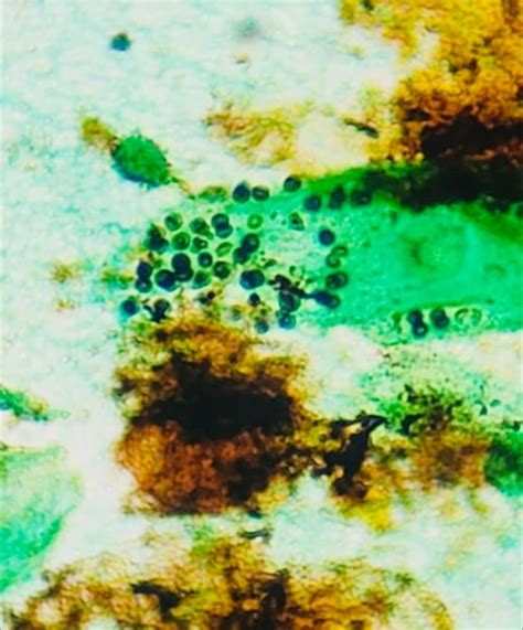 Dr Deepti Jain On Linkedin Teamwork Histopathology Pathologist