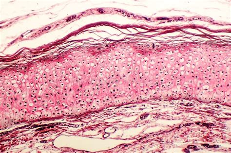 Ear Cartilage Histology