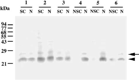 Correlation Between Prommp 2 Activation Ratios And Expression Levels Of