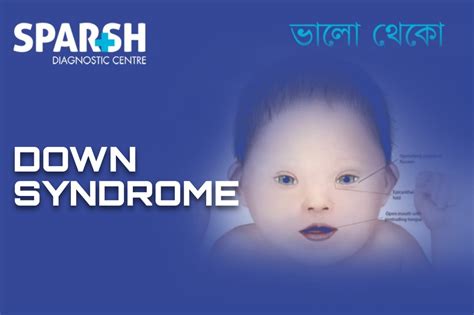 Down Syndrome Sparsh Diagnostic Center