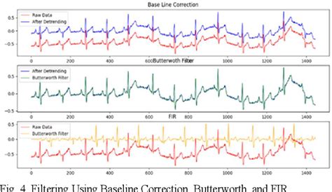 Figure 4 From Classification Of Ecg Signals Using Decision Trees And Linear Discriminant