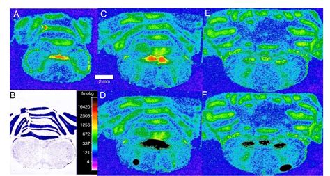 Structure Of Calamus Scriptorius Semantic Scholar